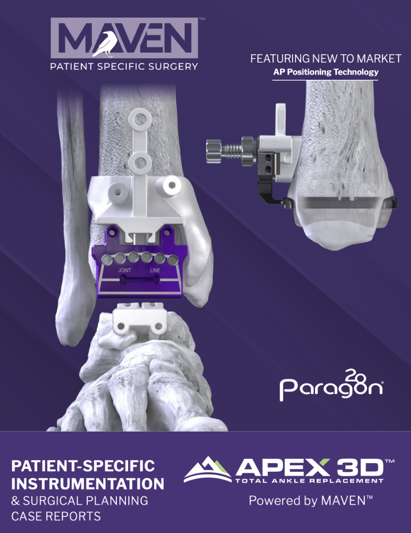 MAVEN™ Patient Specific Instrumentation (PSI) – SMART28℠